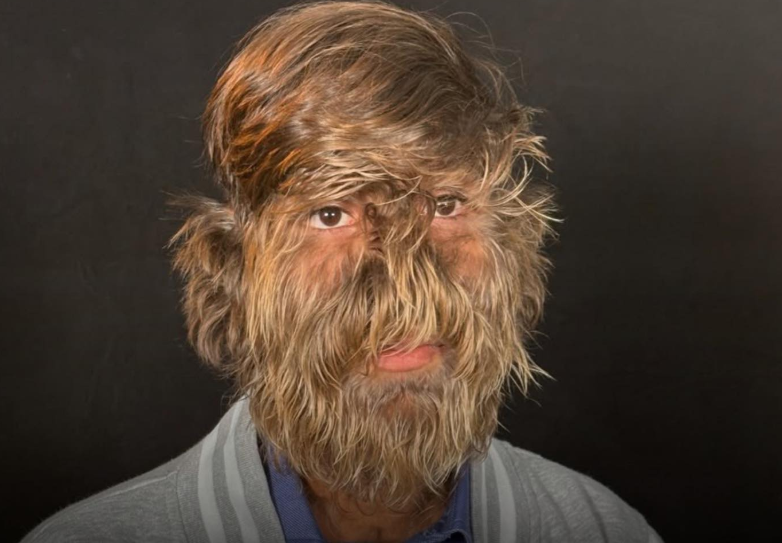 Conheça o jovem 'lobo' que entrou para o Guinness com o rosto mais ...