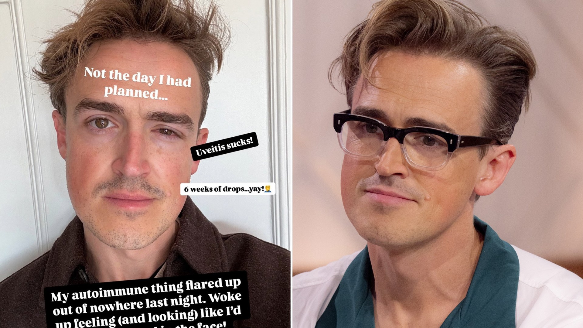 Tom Fletcher taken to hospital after looking like he’d been ‘smashed in ...