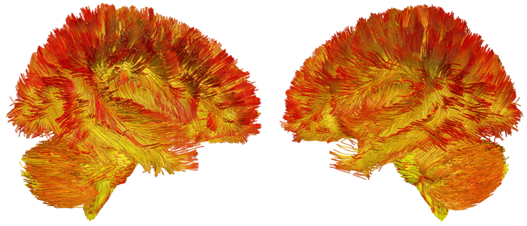 Unprecedented mapping reveals the brain's energy consumption 🧠