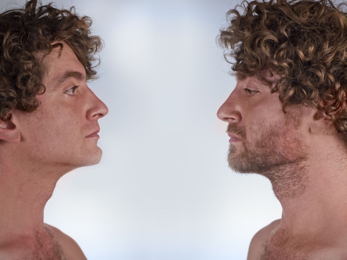 Che cos’è la sindrome del sosia?