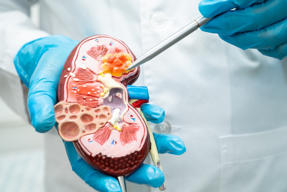 Early signs of kidney disease you should be aware of
