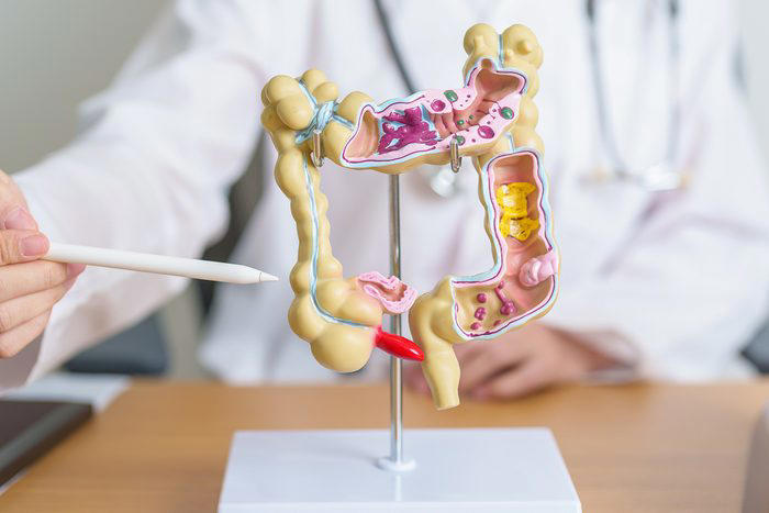 “Why Is My Poop Red?” 9 Possible Reasons, from a Cleveland Clinic G.I ...