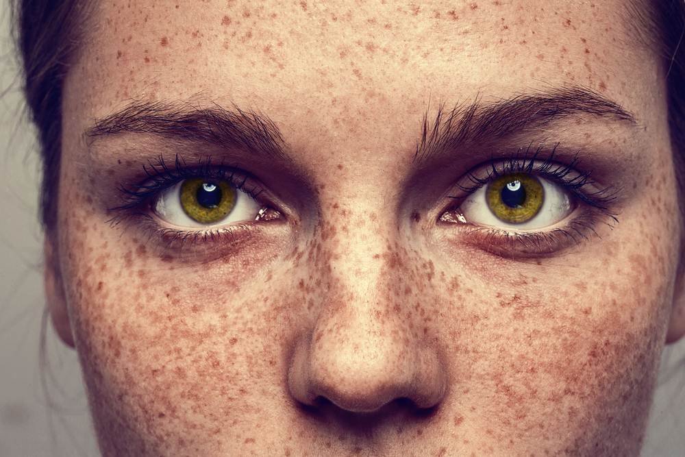 Blue or Brown Eyes? It Matters More for Your Vision Than You Think