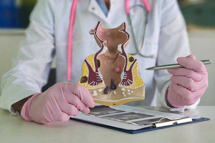 “Why Is My Poop Red?” 9 Possible Reasons, from a Cleveland Clinic G.I ...