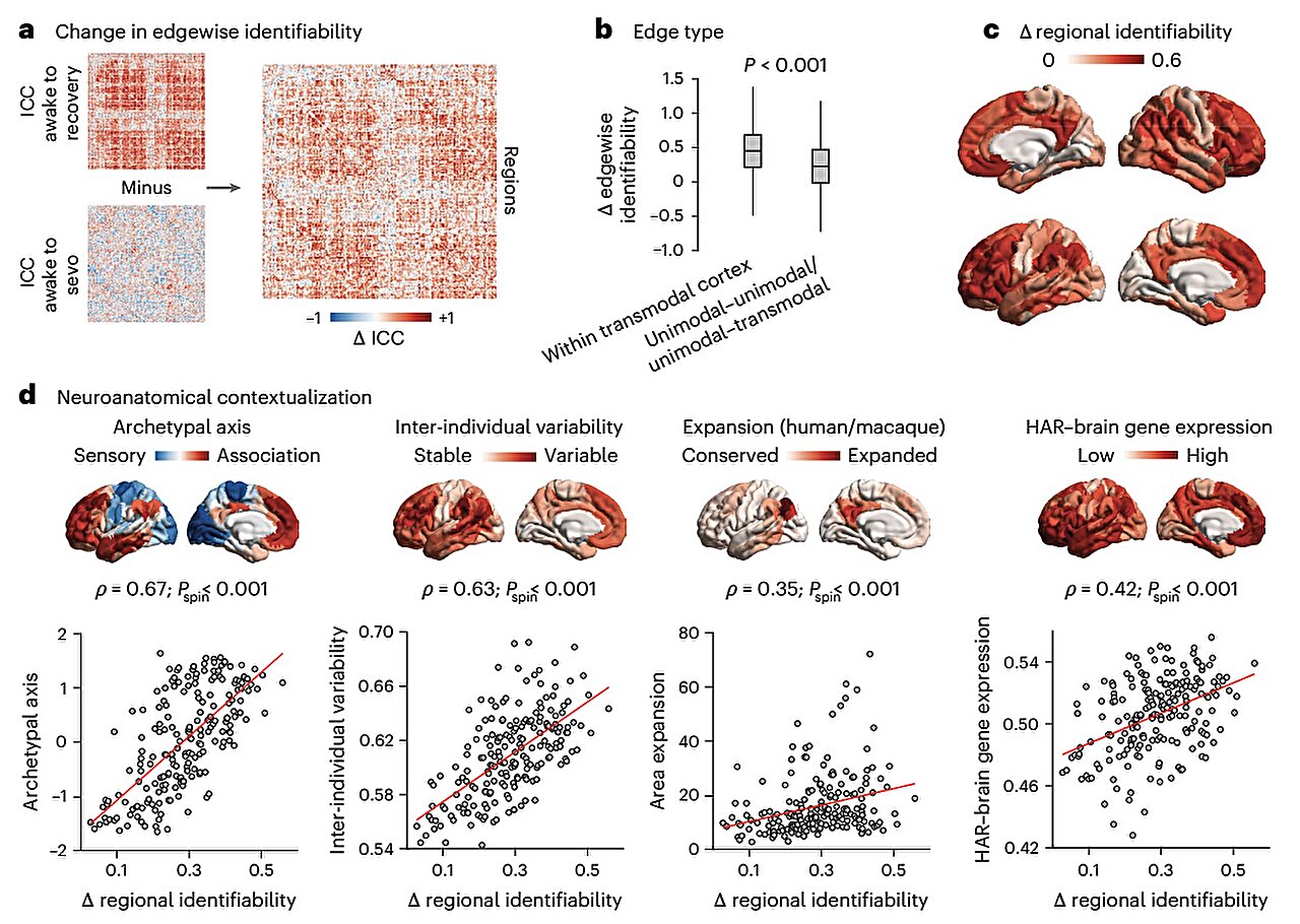 General anesthesia reduces uniqueness of brain's functional ...