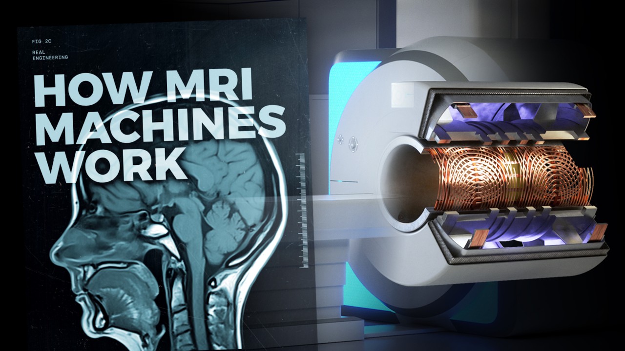 How MRI Machines Use Powerful Magnets to See Inside the Human Body