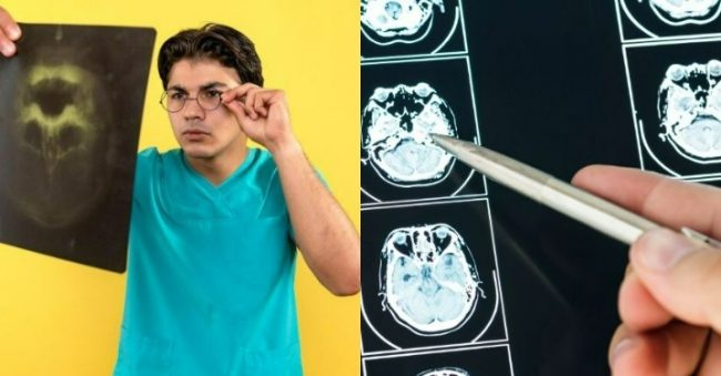 Learn More About Neurofibromatosis: Symptoms, Causes, and Risk Factors ...