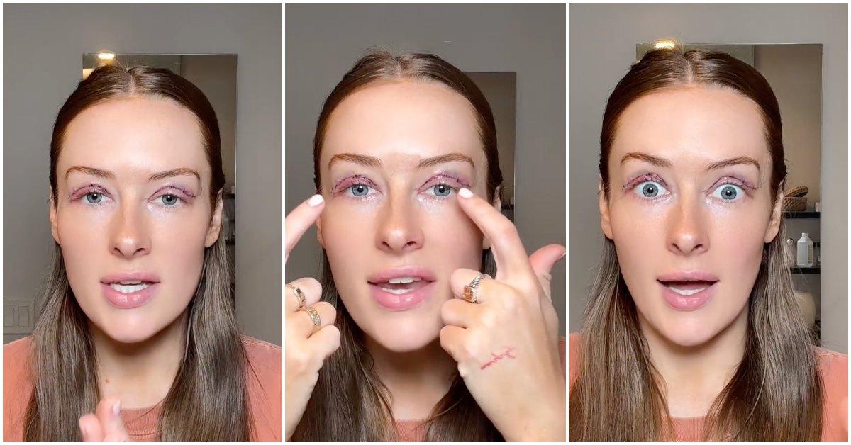 Brooke Schofield Claps Back at Eyelid Surgery Critics — "I Love It."