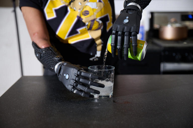 World’s most advanced bionic arm can crawl around on its own