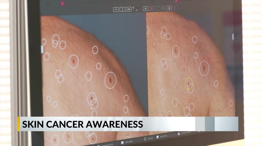 Pro-wrestler and movie star John Cena promotes skin cancer awareness