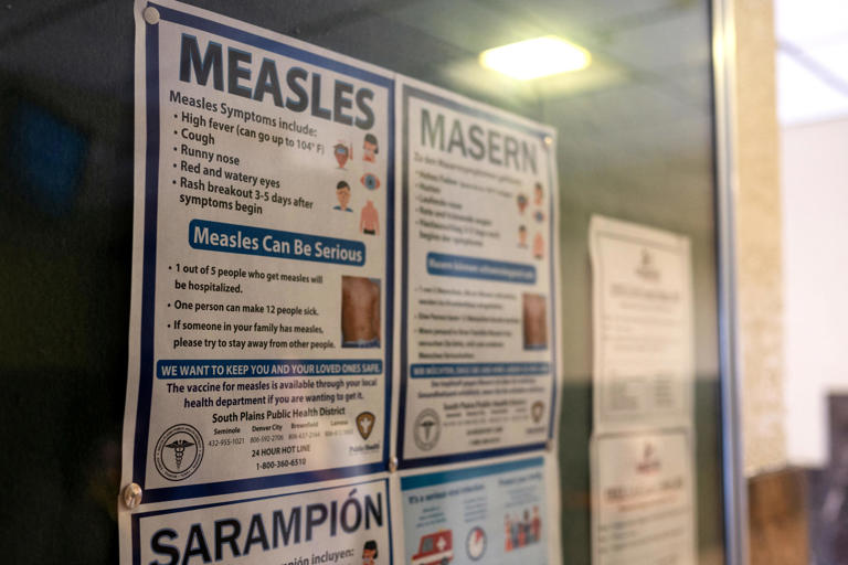 What are the symptoms of measles? How can you prevent measles?