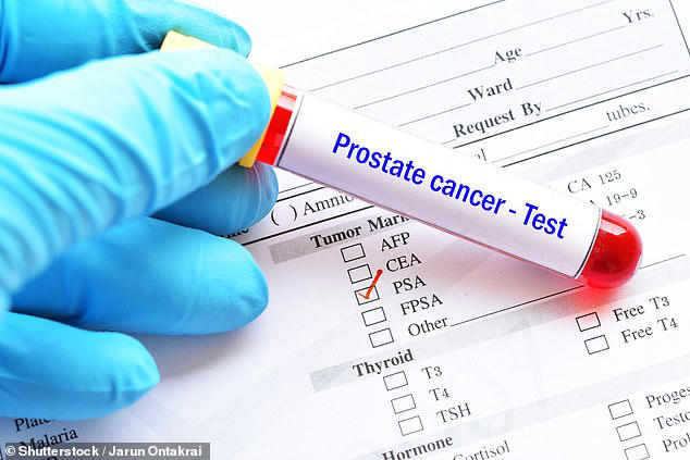 New spit test for prostate cancer that can be carried out at home