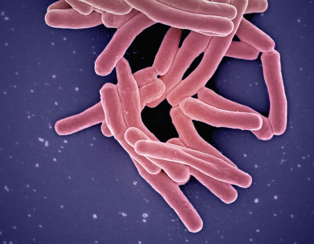 TB harnesses part of immune defense system to cause infection, study finds