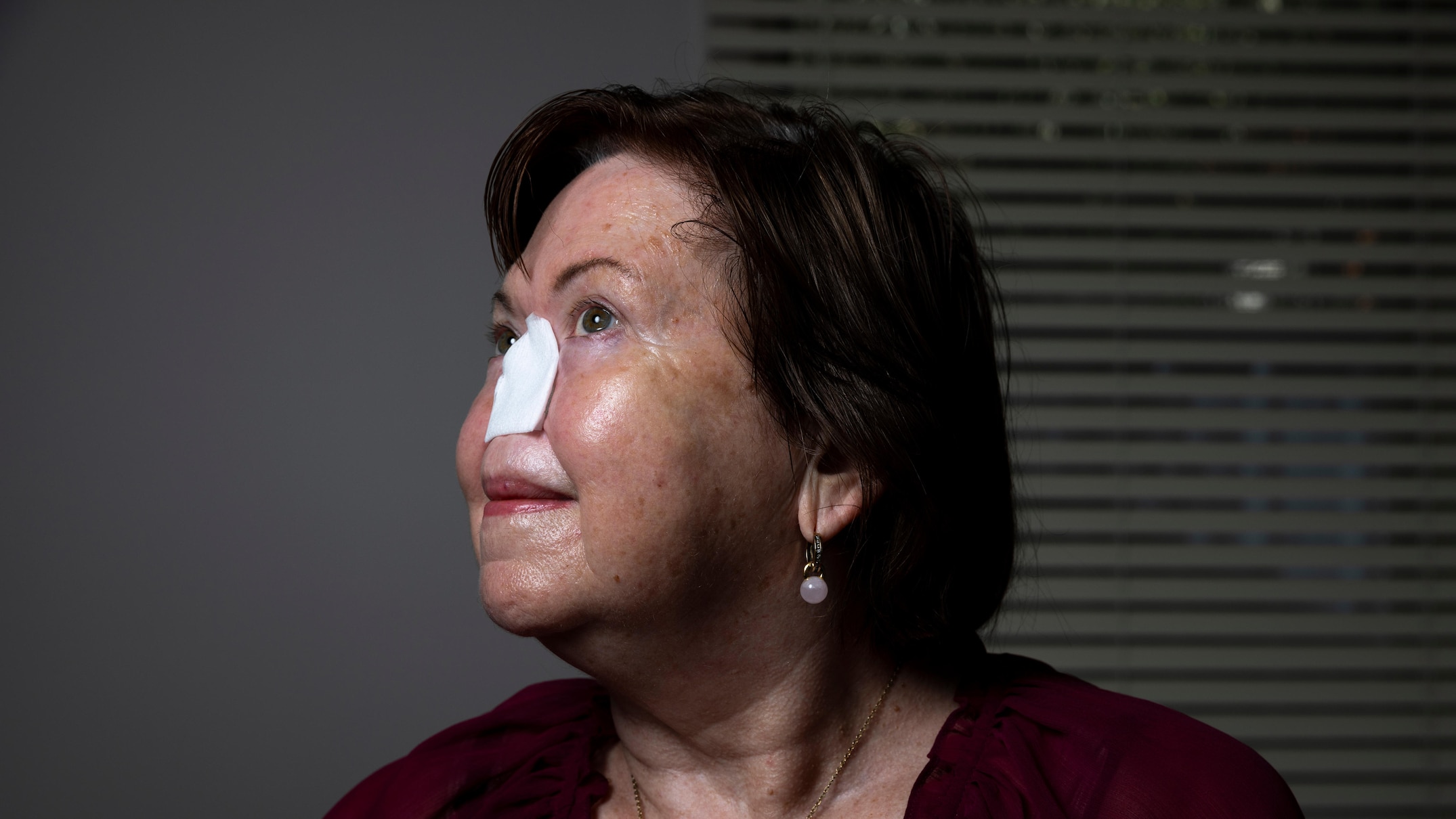 Cancer patients wait for facial prosthetics funding ahead of election