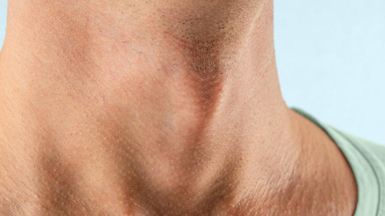 Adam’s Apple: What It Does and Possible Problems and Treatments