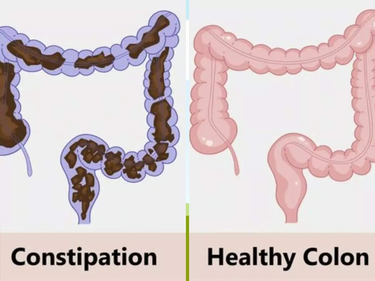 Tired of constipation? Check this viral 'Internal Body Wash' to cleanse ...