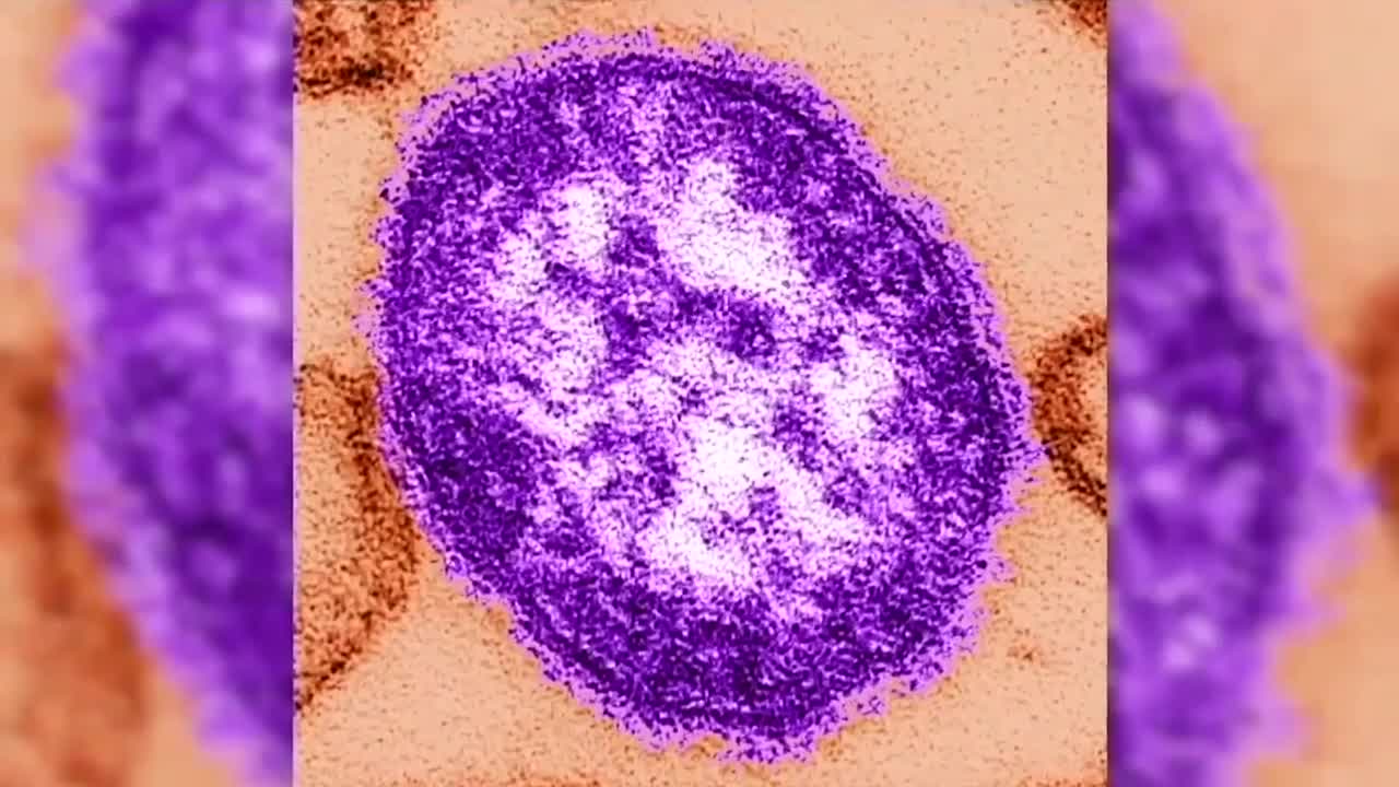 CDPHE recognizes ‘challenging’ reporting delays as measles cases tick up