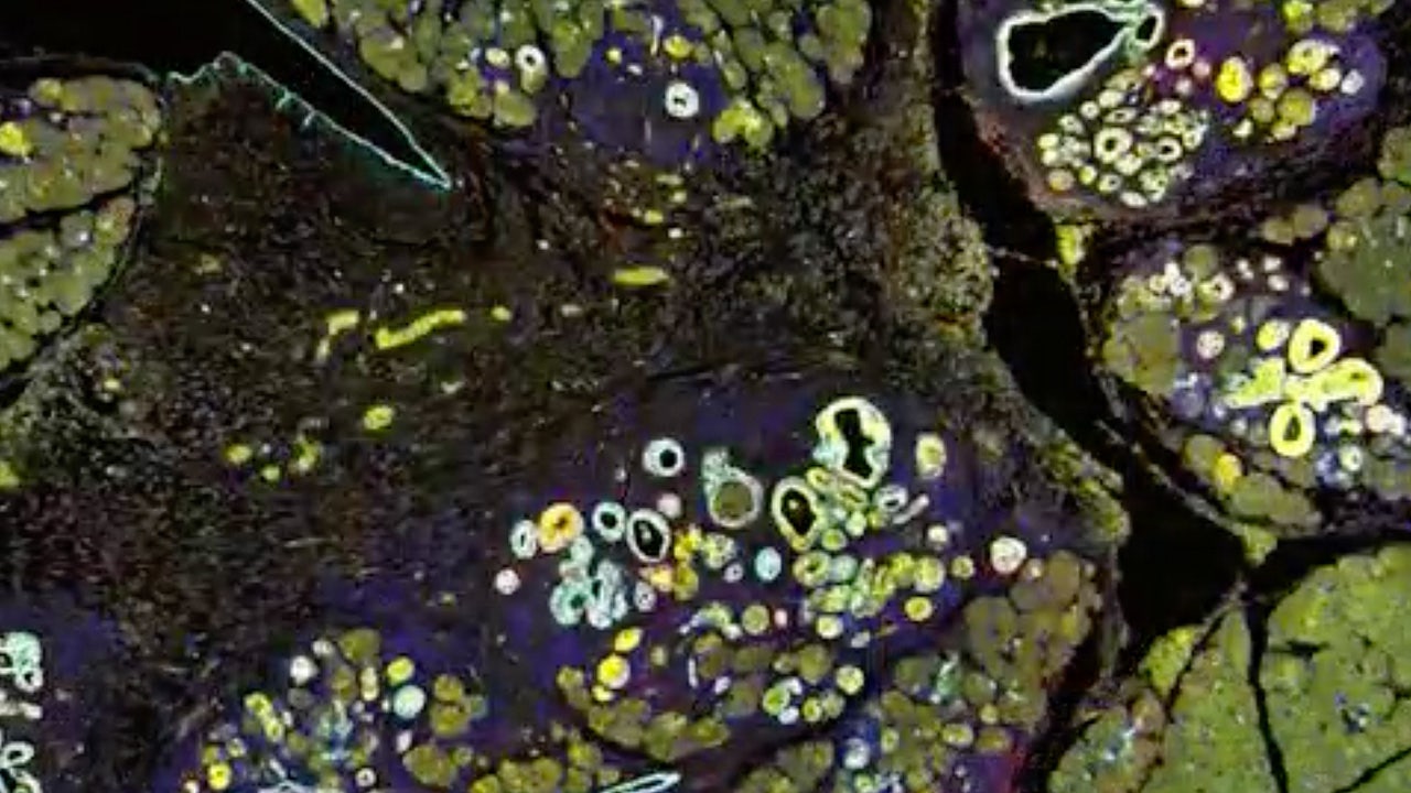 Researchers at Long Island lab discover breakthrough that slows ...