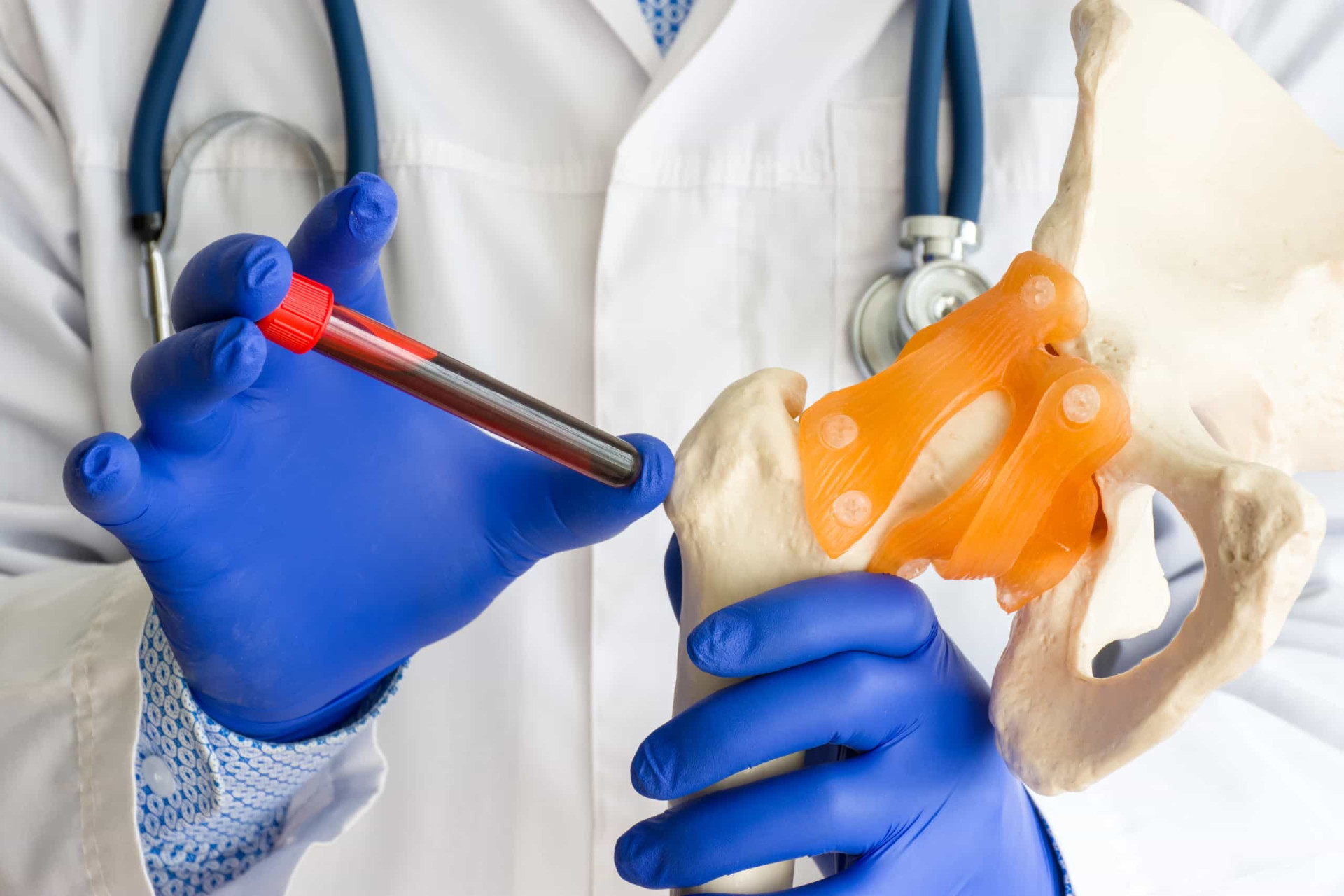 Bone and blood cancer: what you need to know