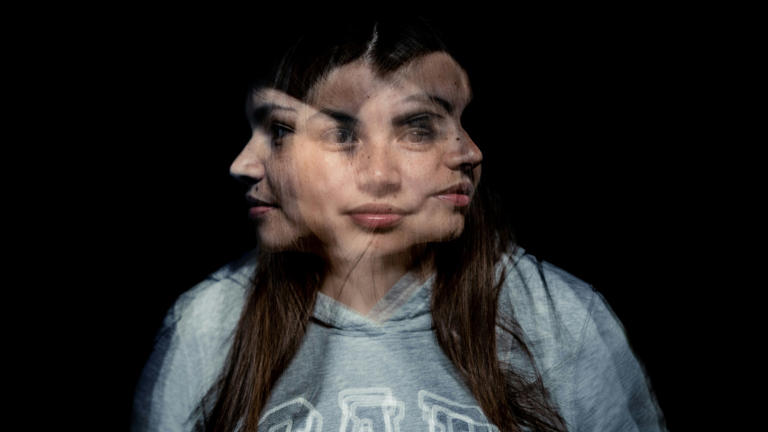 Why Dementia Cases Are Exploding (and What Researchers Say) Why Dementia Cases Are Exploding (and What Researchers Say)