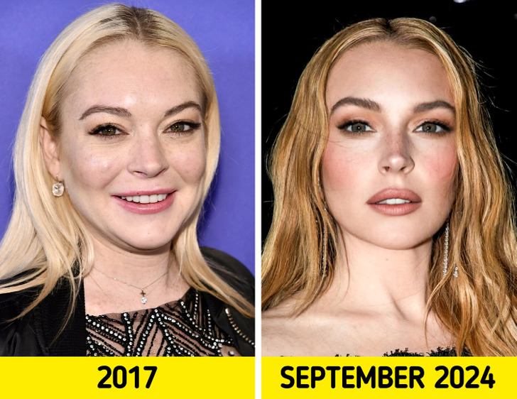 Lindsay Lohan Shocks the Internet Again With New Look, Plastic Surgeon ...