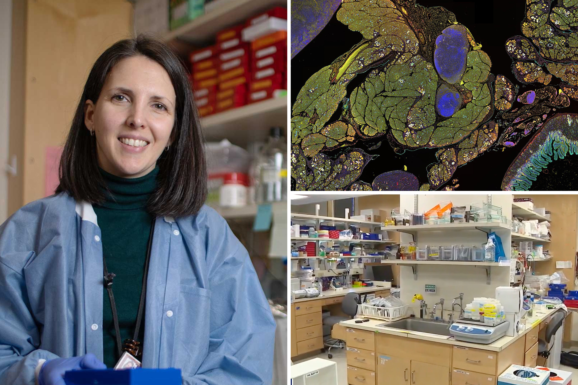 NY lab discovers pancreatic cancer breakthrough that can ‘intercept’ spread