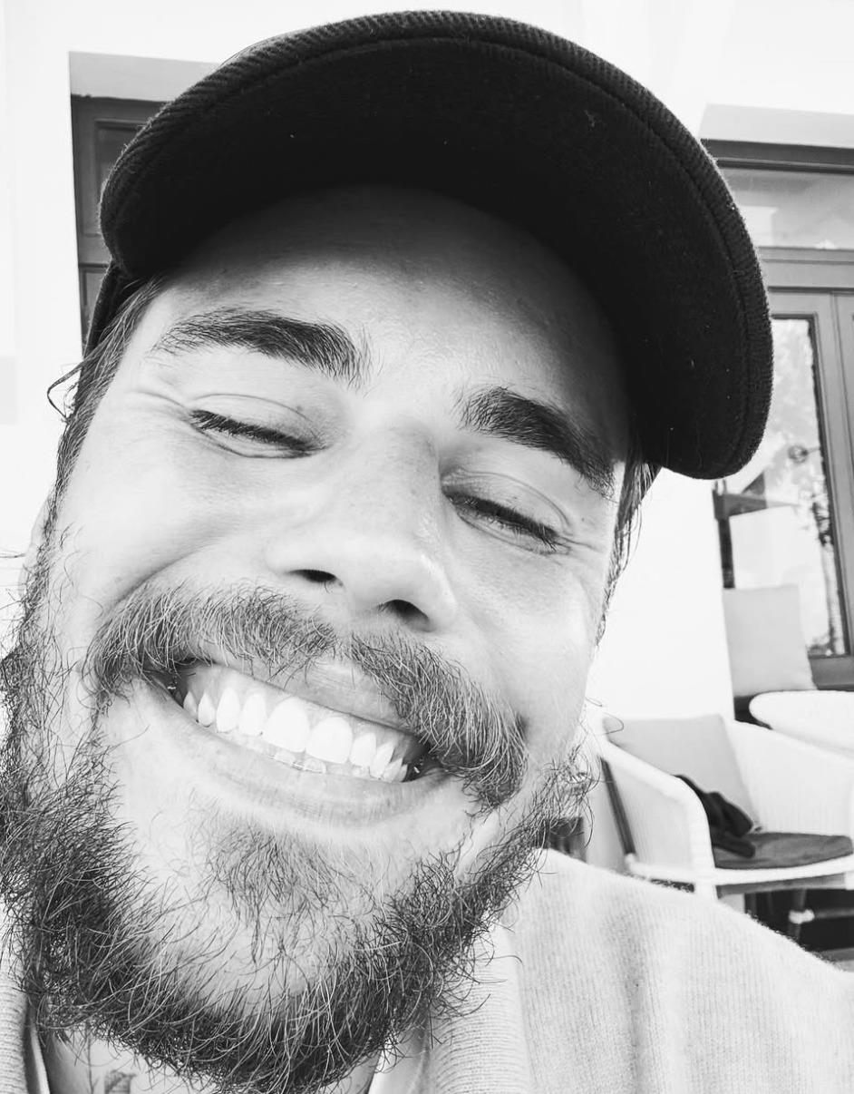 Justin Bieber, il prima e dopo: magrissimo, occhi incavati e sguardo ...