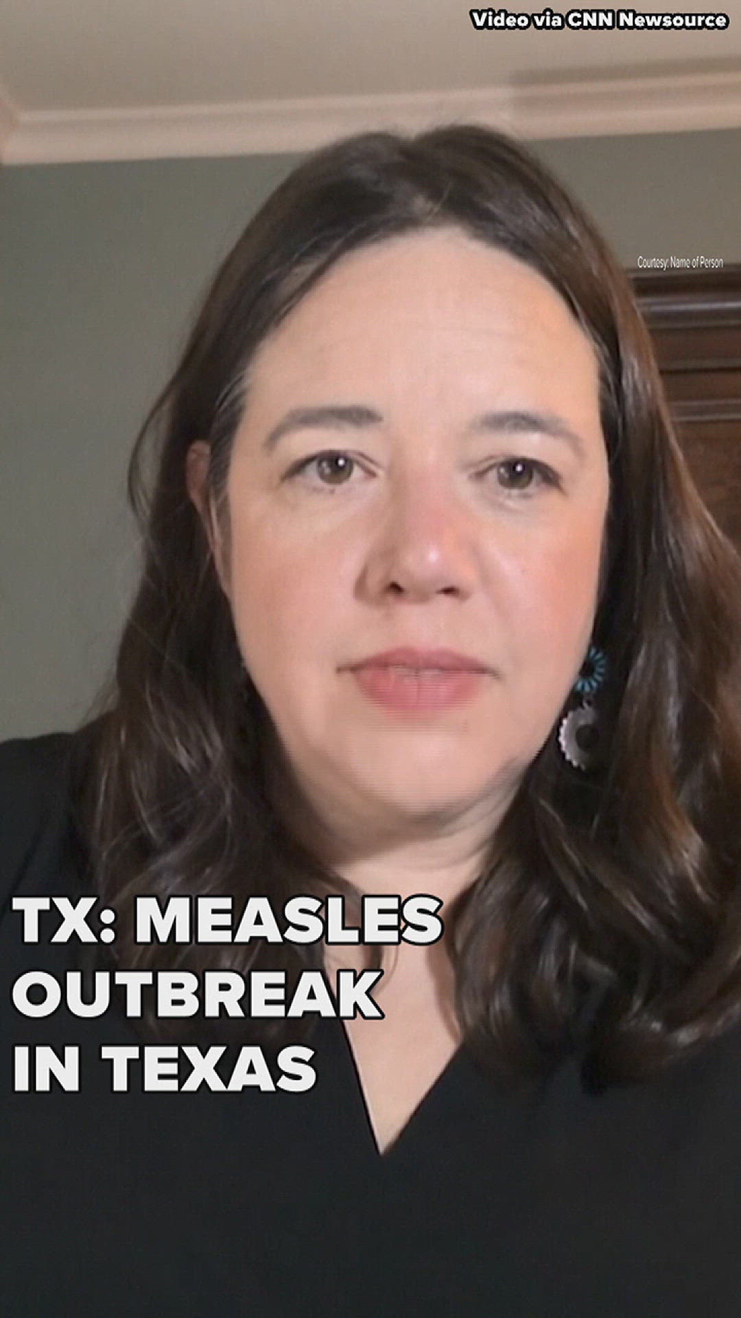 Measles outbreak in Texas