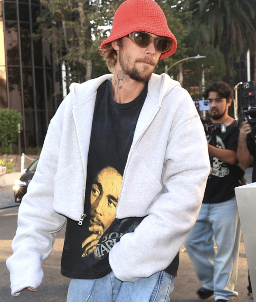 Justin Bieber, il prima e dopo: magrissimo, occhi incavati e sguardo ...