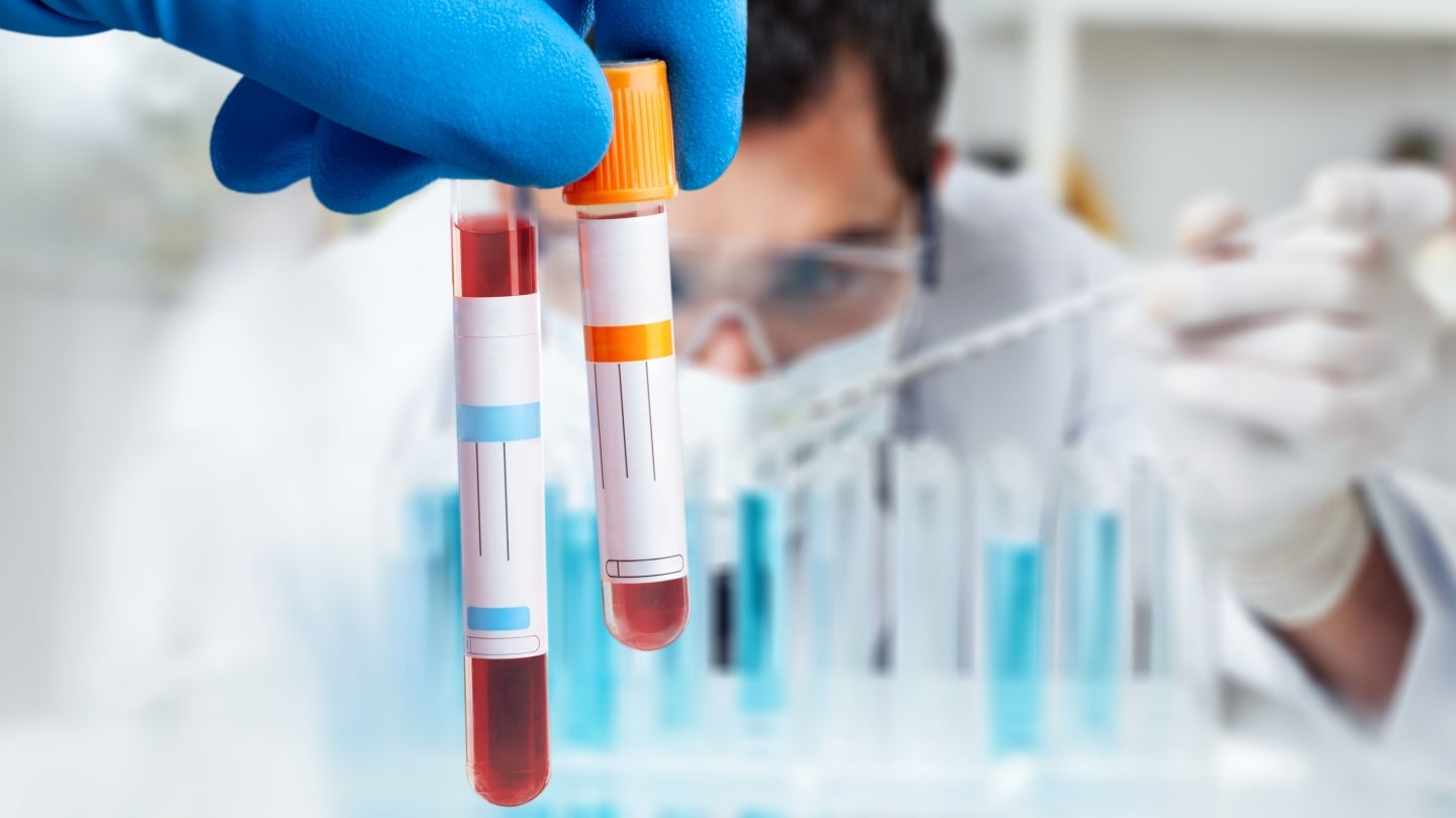 Quest introduces blood test to confirm amyloid brain pathology in ...