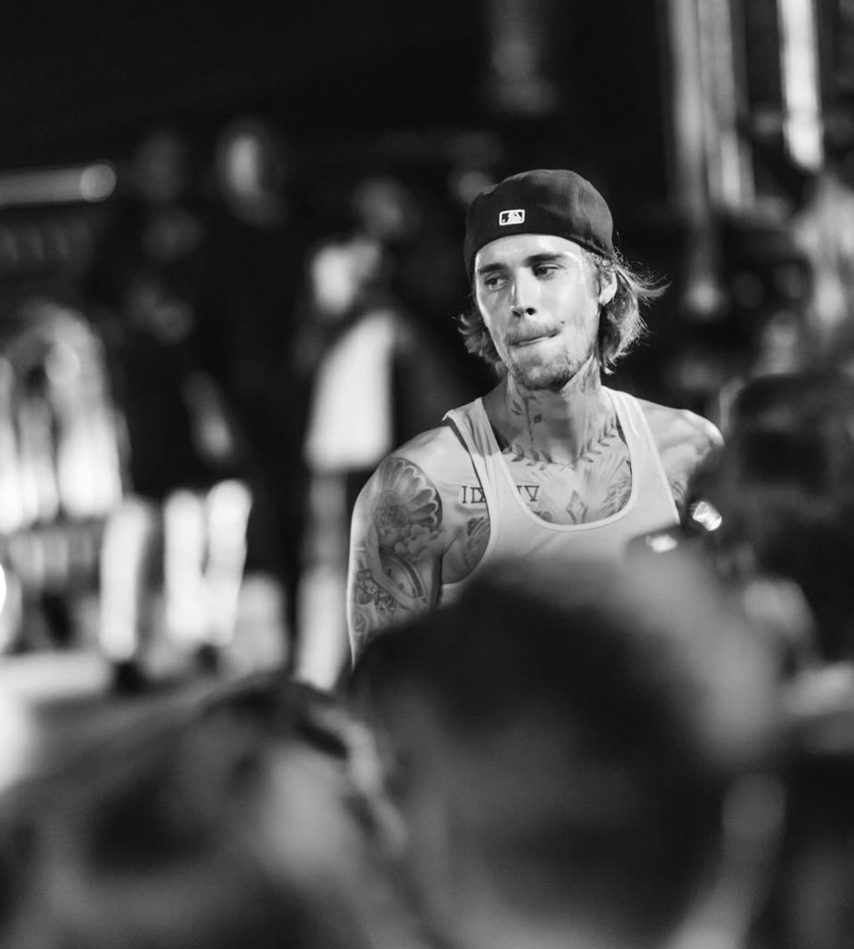 Justin Bieber, il prima e dopo: magrissimo, occhi incavati e sguardo ...