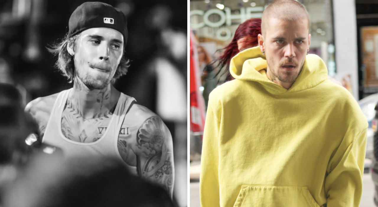 Justin Bieber, come sta il cantante: la preoccupazione dei fan e l ...