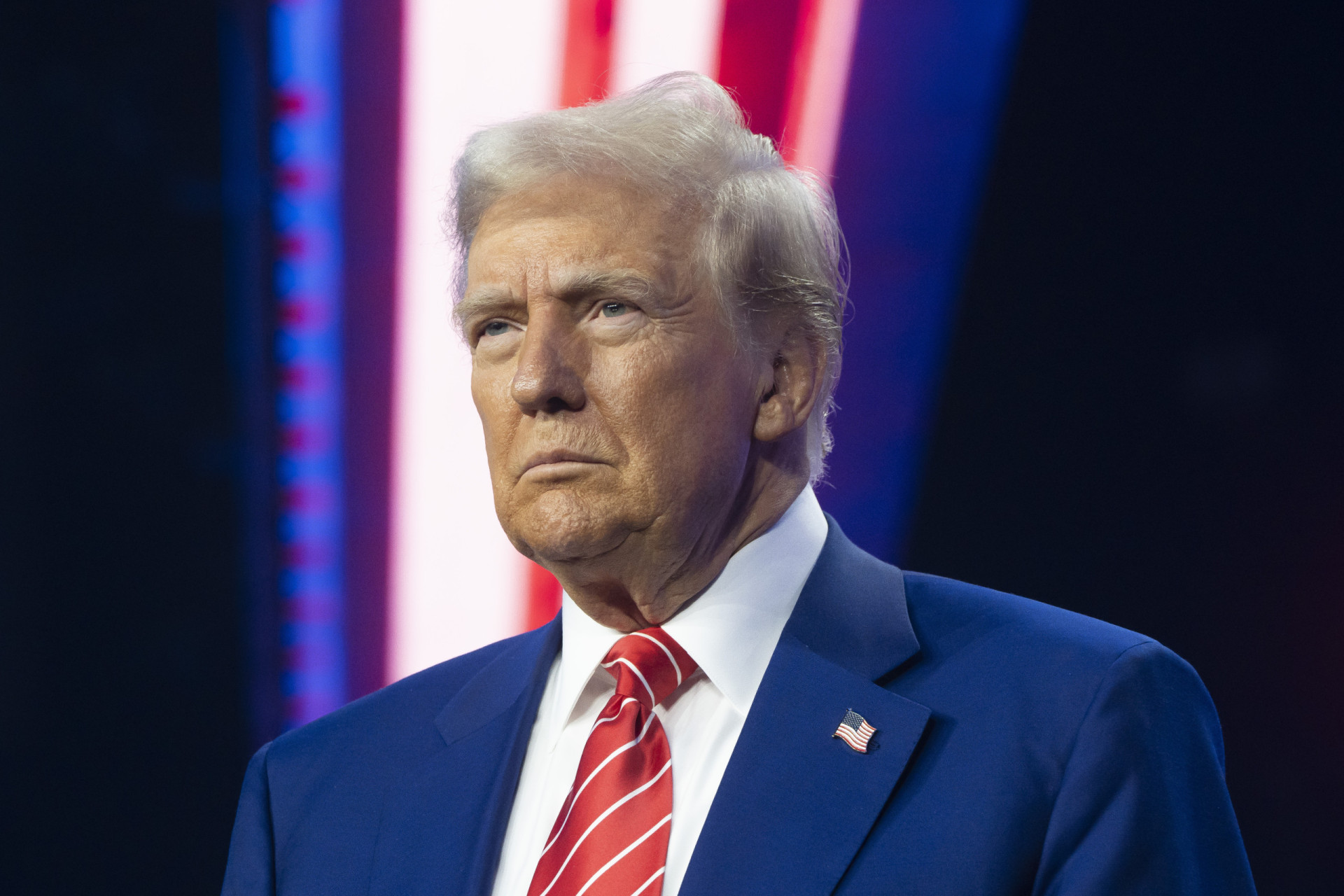 Trump diagnosed with chronic venous insufficiency