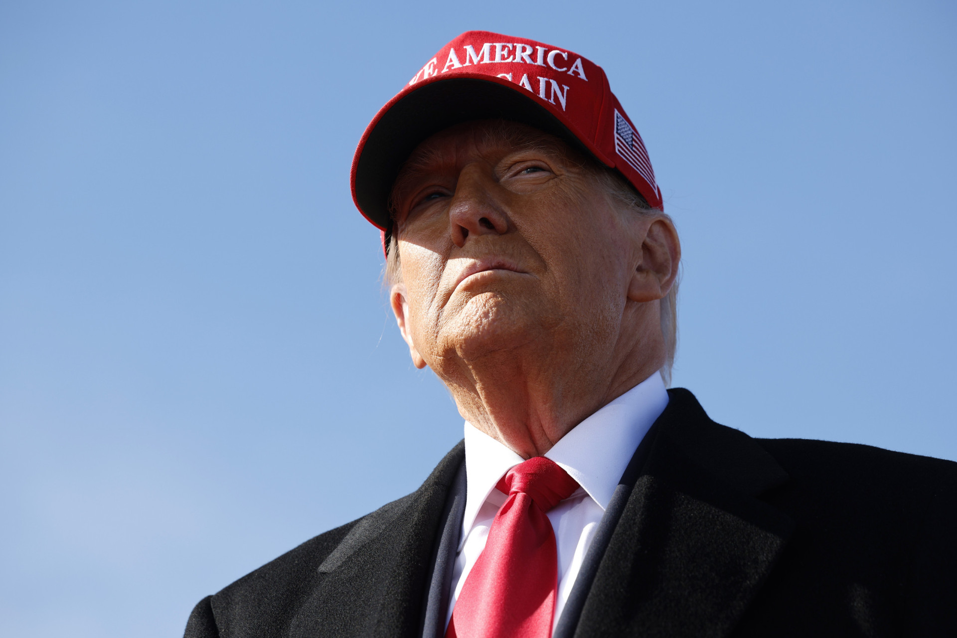 Trump diagnosed with chronic venous insufficiency