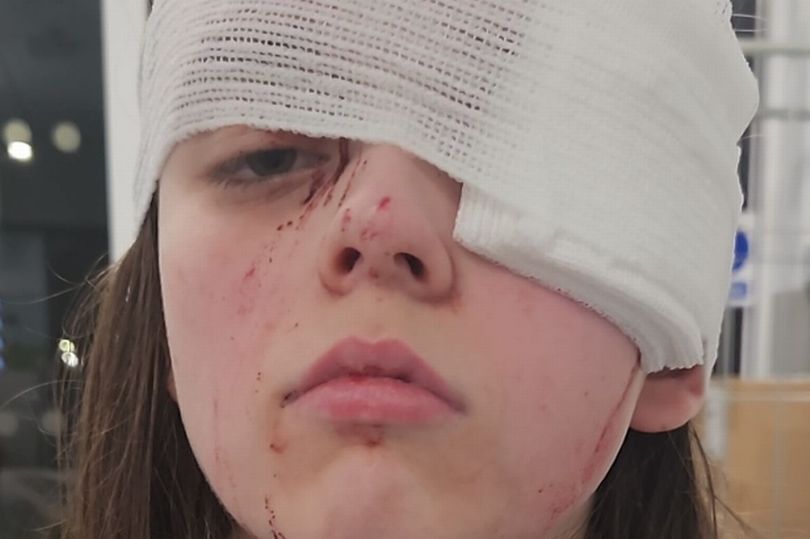 Horror deodorant can blast blinds schoolgirl as face dripped in blood ...