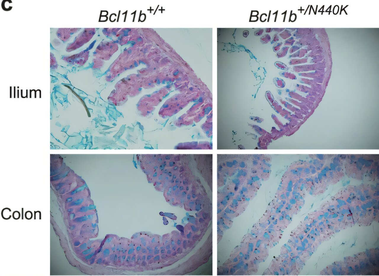 How one bad protein can affect both immunity and brain development