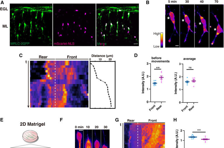 Squeezing through: Understanding how neurons migrate through crowded ...