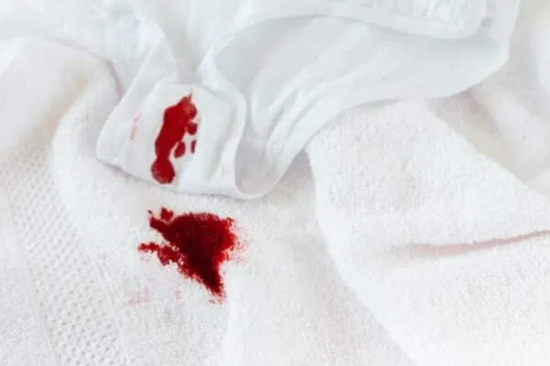 How to easily remove period blood stains from sheets