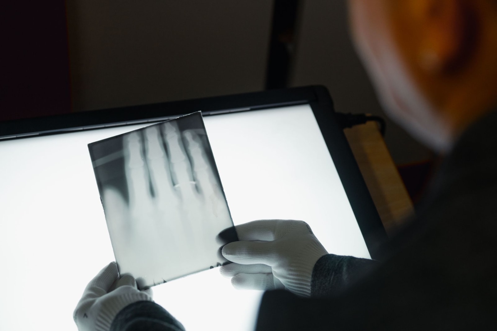 X-ray images, Nietzsche estate join UNESCO Memory of World register