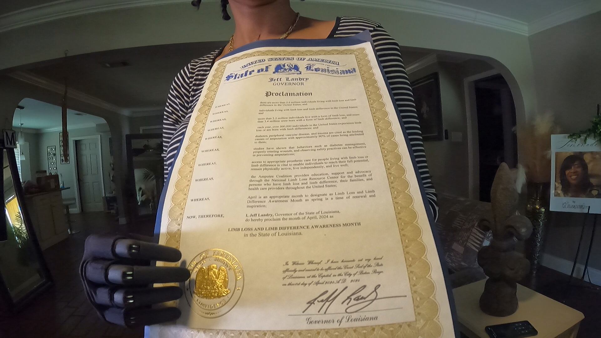 Baton Rouge amputee authors story, continues advocating