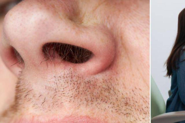 Los síntomas del cáncer de nariz que confunden a las personas con otras ...