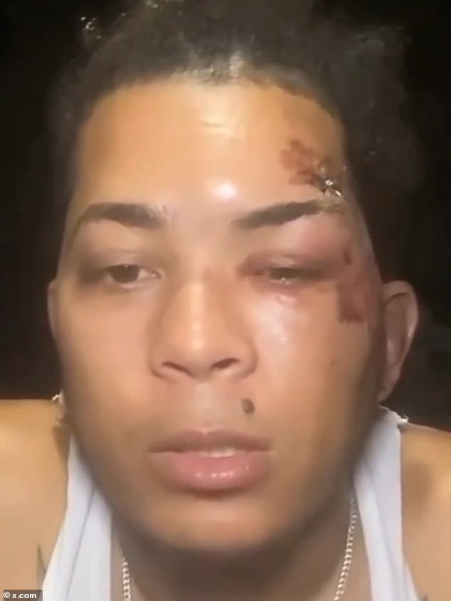 Shameless act of attention-seeker after deadly nightclub collapse