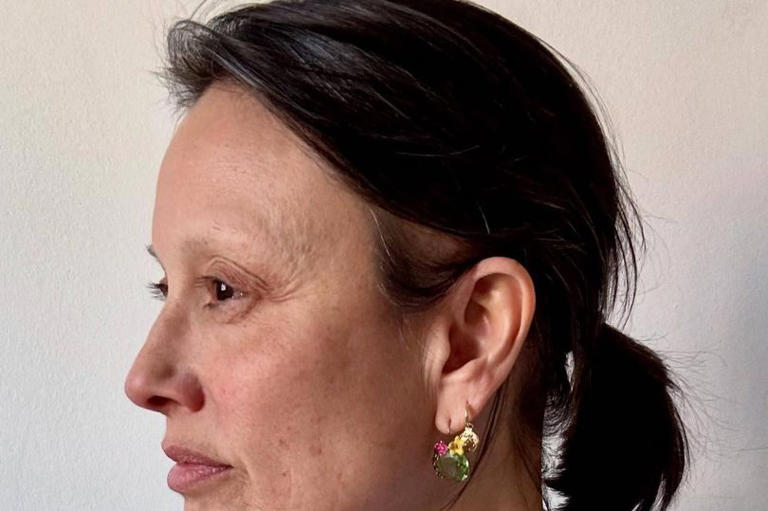 Melanie Sykes' devastating health update showing she's 'lost half her hair'