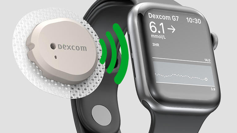 How To Connect Dexcom G7 To Your Apple Watch (And Which Models Are ...