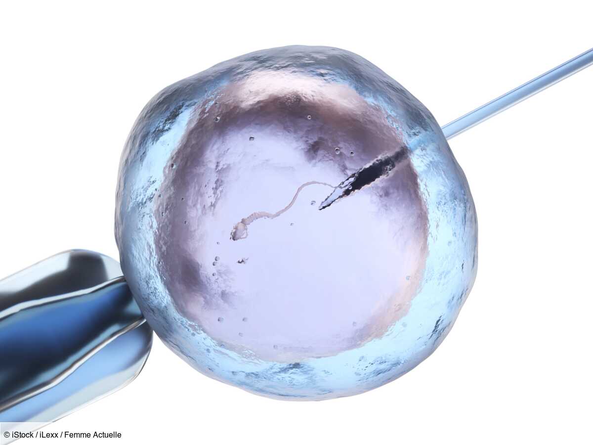Maturation in vitro (MIV) : moins connue que la FIV, qu'est-ce que ...