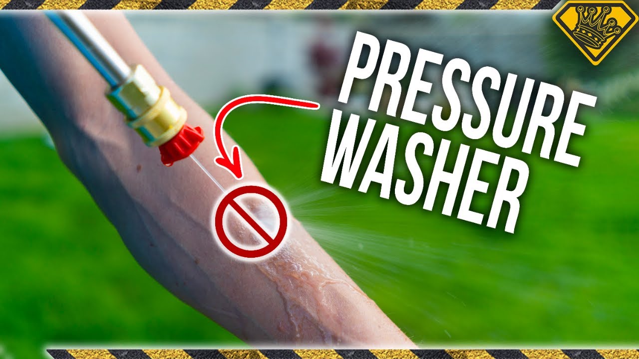 What Happens When Skin Meets a Pressure Washer?