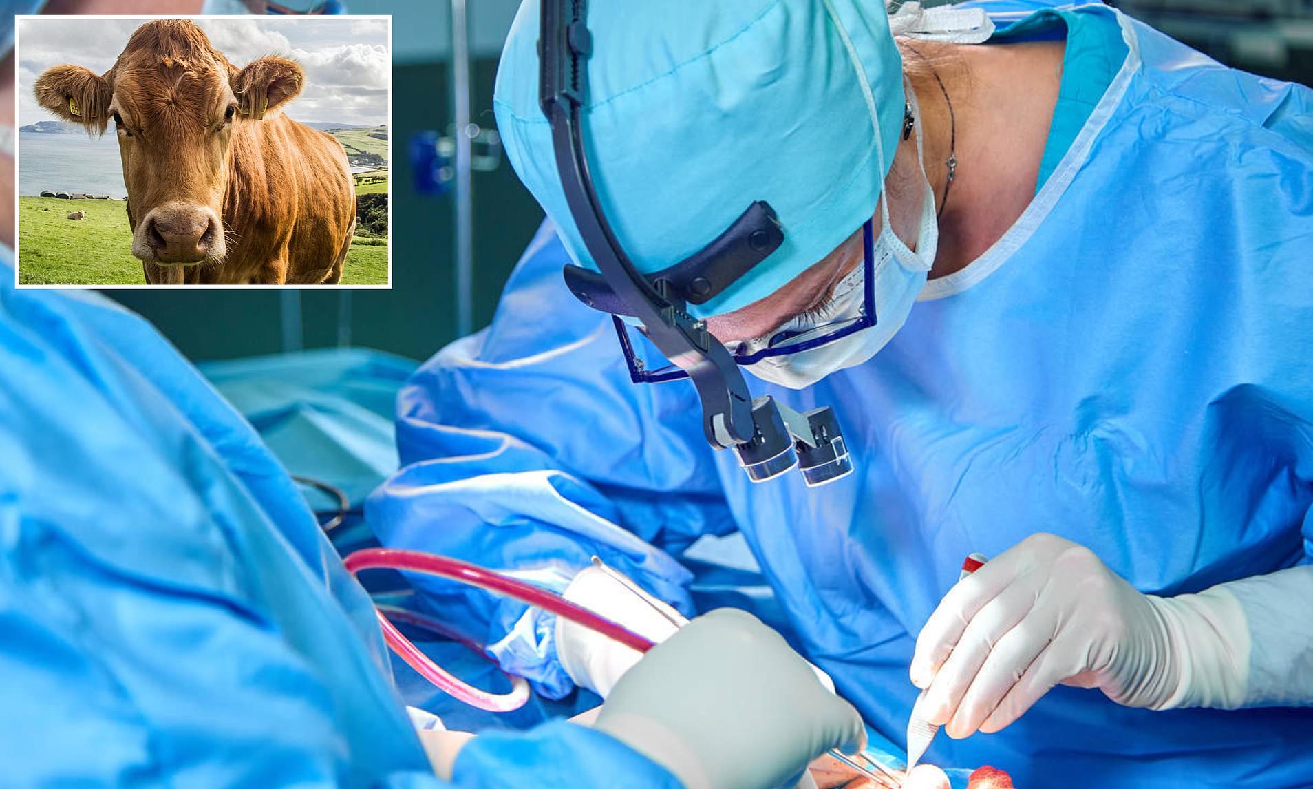 Cow hide used in NHS skin grafts for severe facial wounds