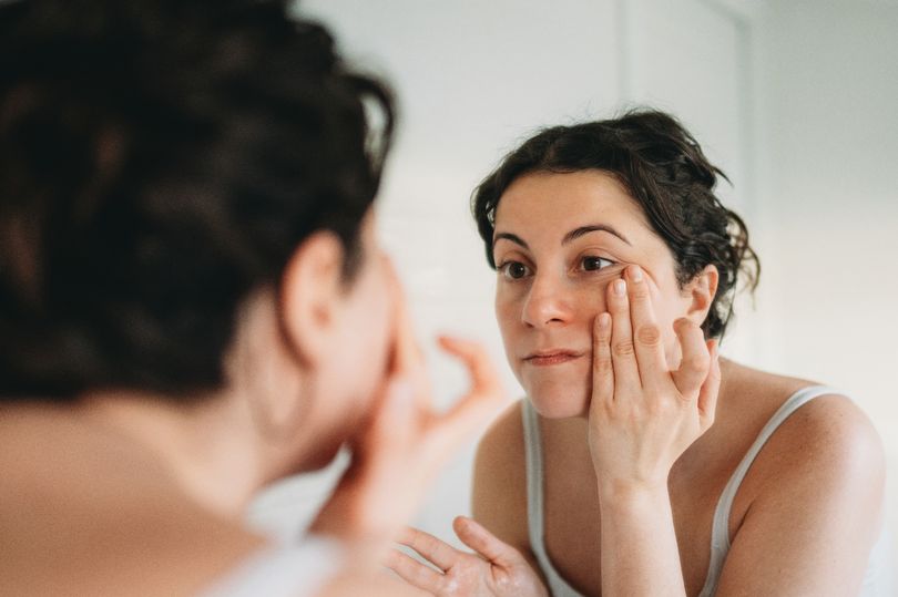 Check around the eyes for 2 lesser-known signs of high cholesterol