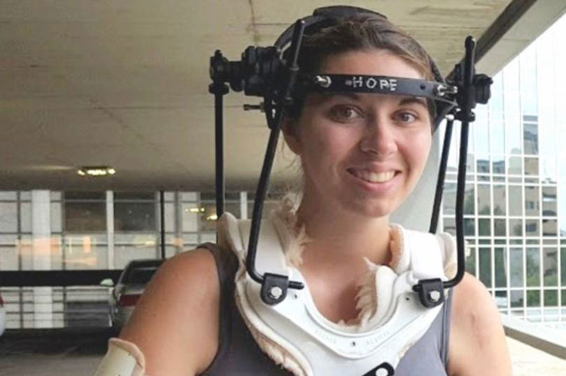 Woman 'internally decapitated' has head reattached in miracle operation Woman 'internally decapitated' has head reattached in miracle operation