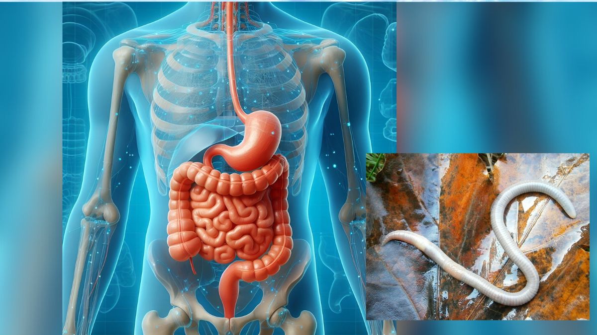 Why Every Parent Should Know About Worm Infections After This ...